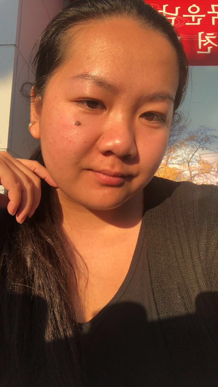 10 STEP KOREAN SKIN CARE ROUTINE FOR ACNE PRONE SKIN – myHUBS